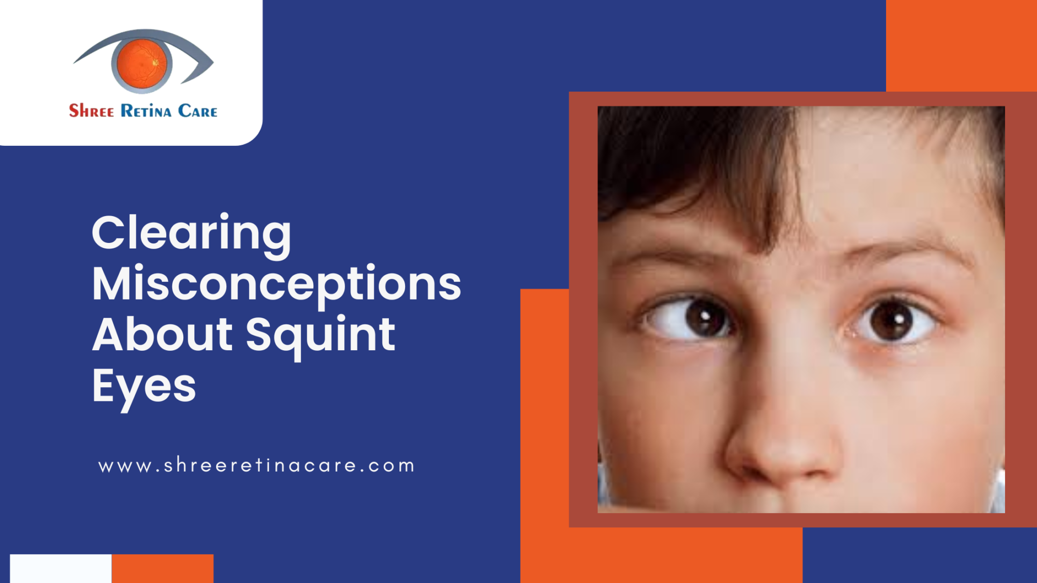 Clearing Misconceptions About Squint Eyes