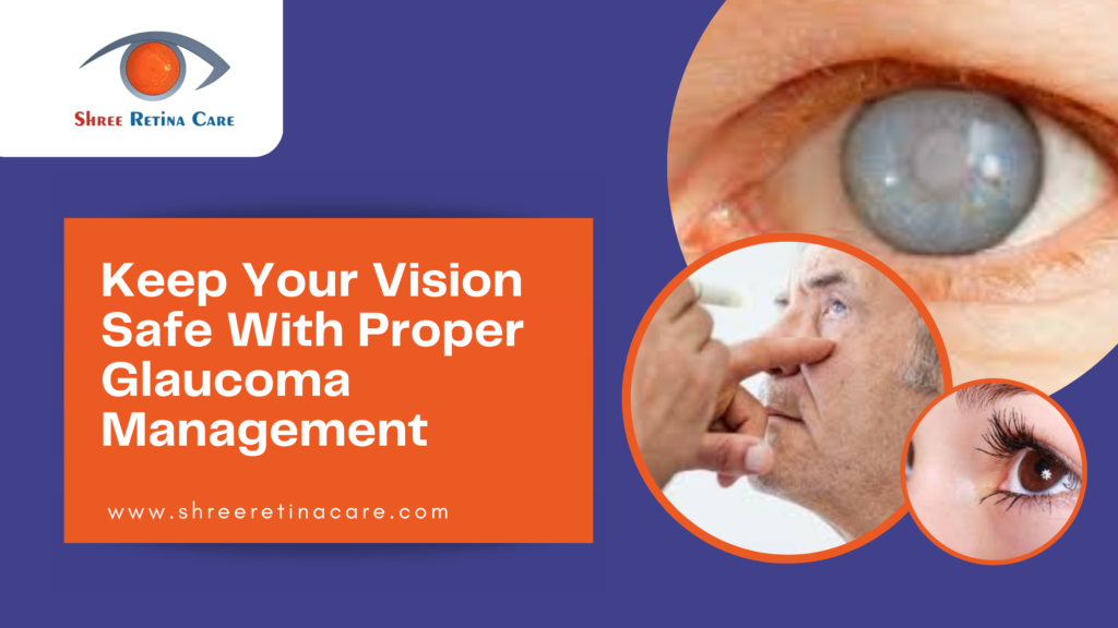 Keep Your Vision Safe With Proper Glaucoma Management