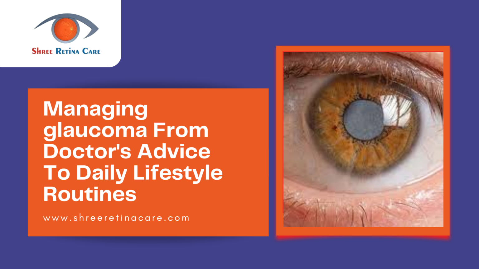 Managing glaucoma From Doctor's Advice To Daily Lifestyle Routines