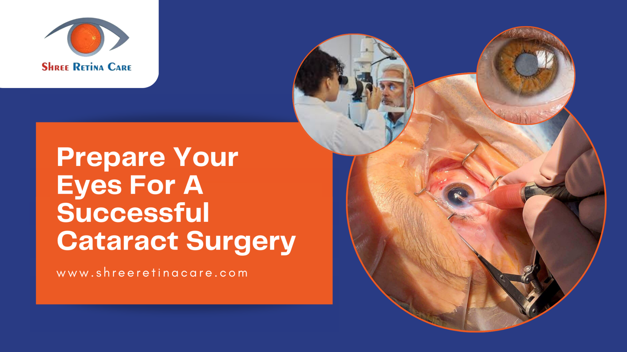 Prepare Your Eyes For A Successful Cataract Surgery