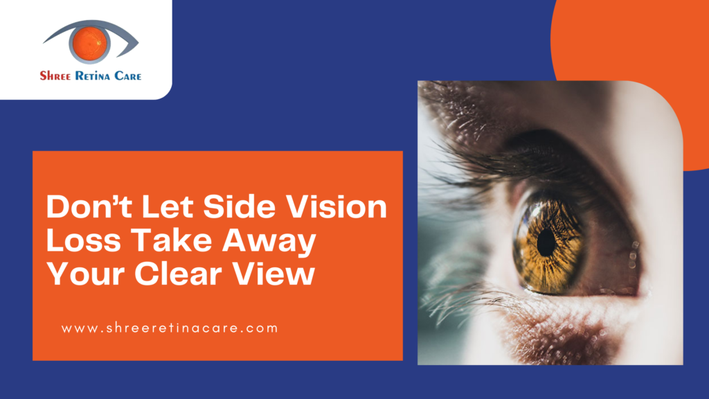 Don’t Let Side Vision Loss Take Away Your Clear View