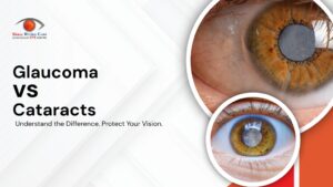 Glaucoma vs Cataracts: Which Is More Serious?